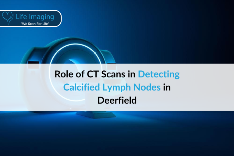 CT Scans for Calcified Lymph Nodes in Deerfield - Life Imaging FLA