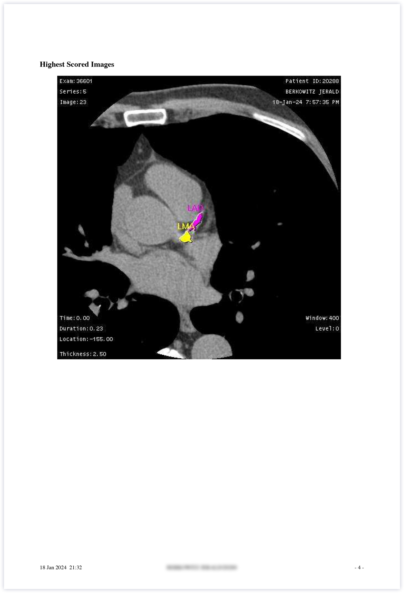 Sample Reports - Life Imaging FLA