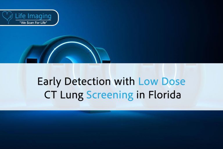 Early Detection with Low Dose CT Lung Screening in Florida | Life ...
